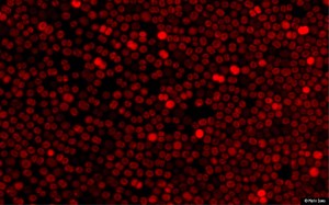 Algae Printing – Intersection of design and science